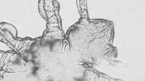 Natroba™ (spinosad) & Head Lice | For Healthcare Professionals