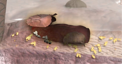 Why Choose Natroba™ for Treating Scabies